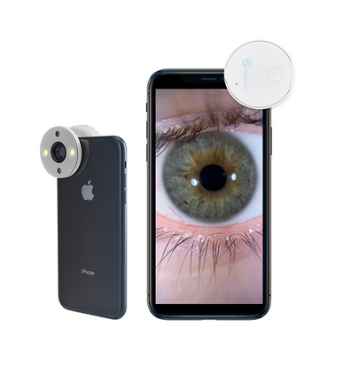 QuikVue VPA-100, phone Eye Imaging Adapter | Anterior eye segment ...