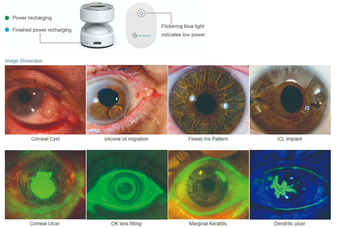 QuikVue Plus VPA-200 with yellow filter, phone adapter | Anterior eye ...