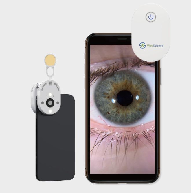 QuikVue Plus VPA-200 with yellow filter, phone adapter | Anterior del ...